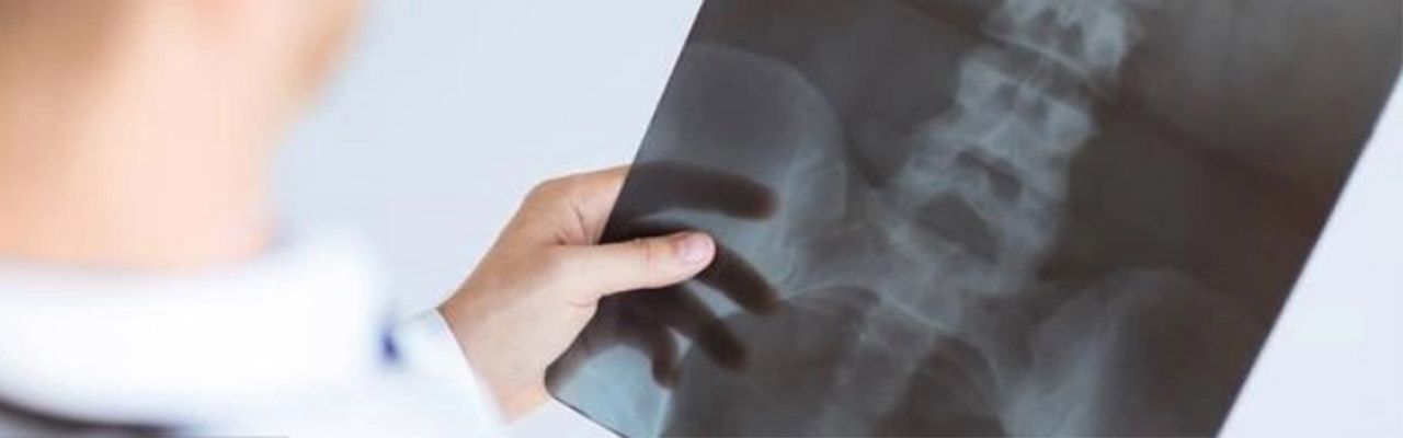 Rendgen karlice 3.500 RSD | Dijagnostički centar HRAM